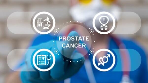 Explore the 2025 Draft Prostate Cancer Screening Guidelines by PCFA ...